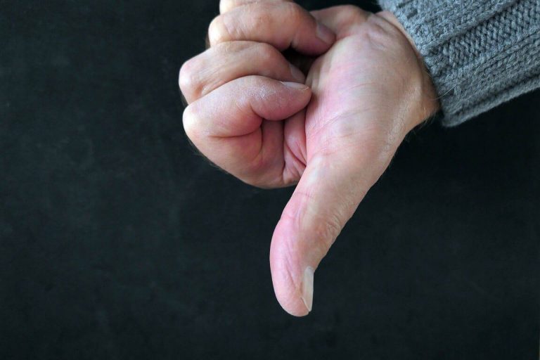 Your Thumb Shape Can Reveal Amazing Things About Your Personality?